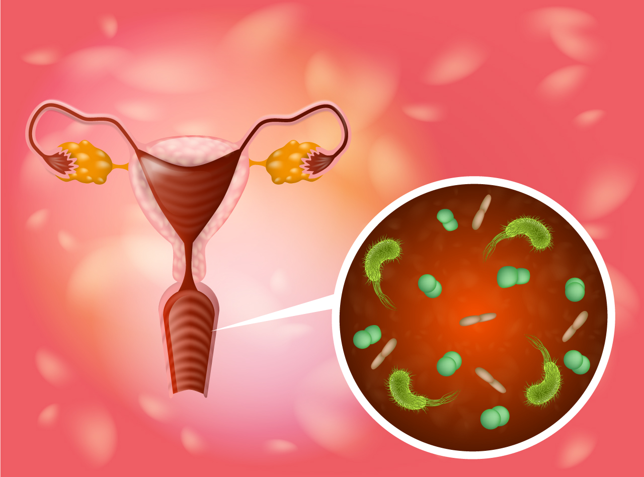Candidíase: a relação dela com a alimentação que você precisa saber
